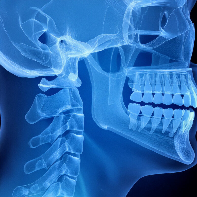 Orthognathic Surgery In London | Harley Street Maxillofacial Clinic